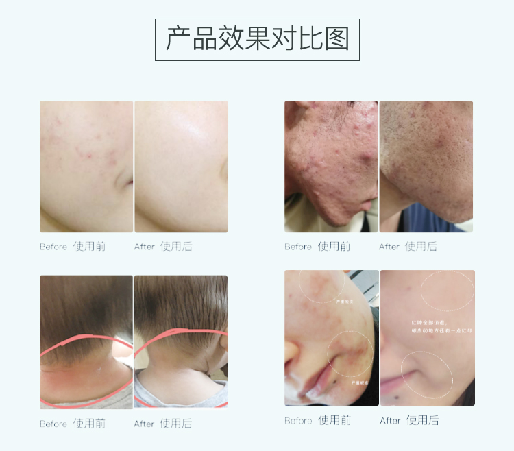 GOOCOS清爽套装 - DERMIND|德尔蔓官网-让护肤变成一种享受，让效果不再是想象